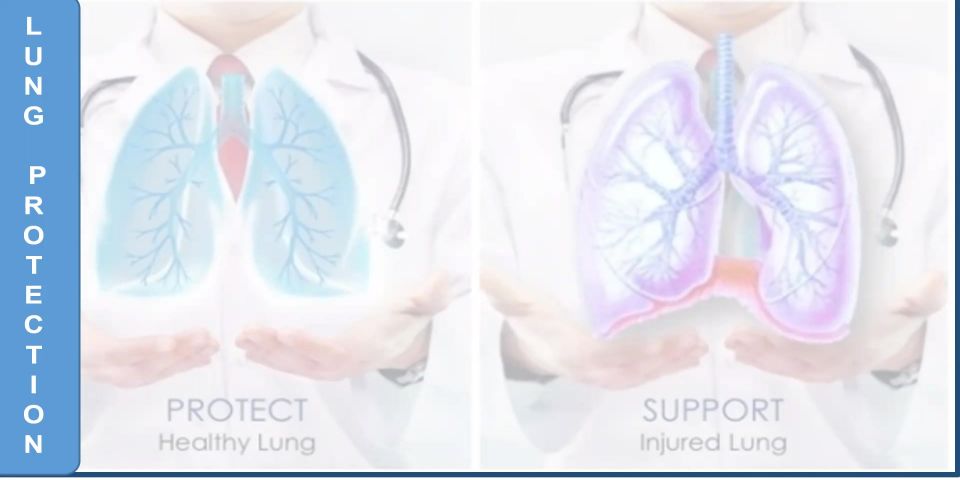 Modes of Ventilation | media.heanet.ie